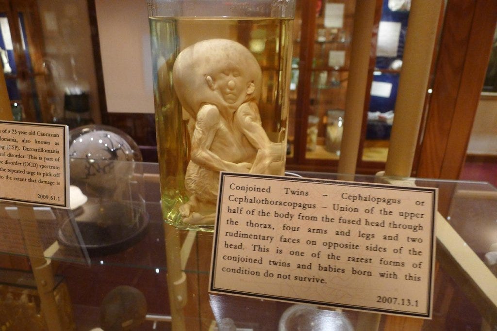 Will Mutter Museum return to its wonderful, horrible ways?